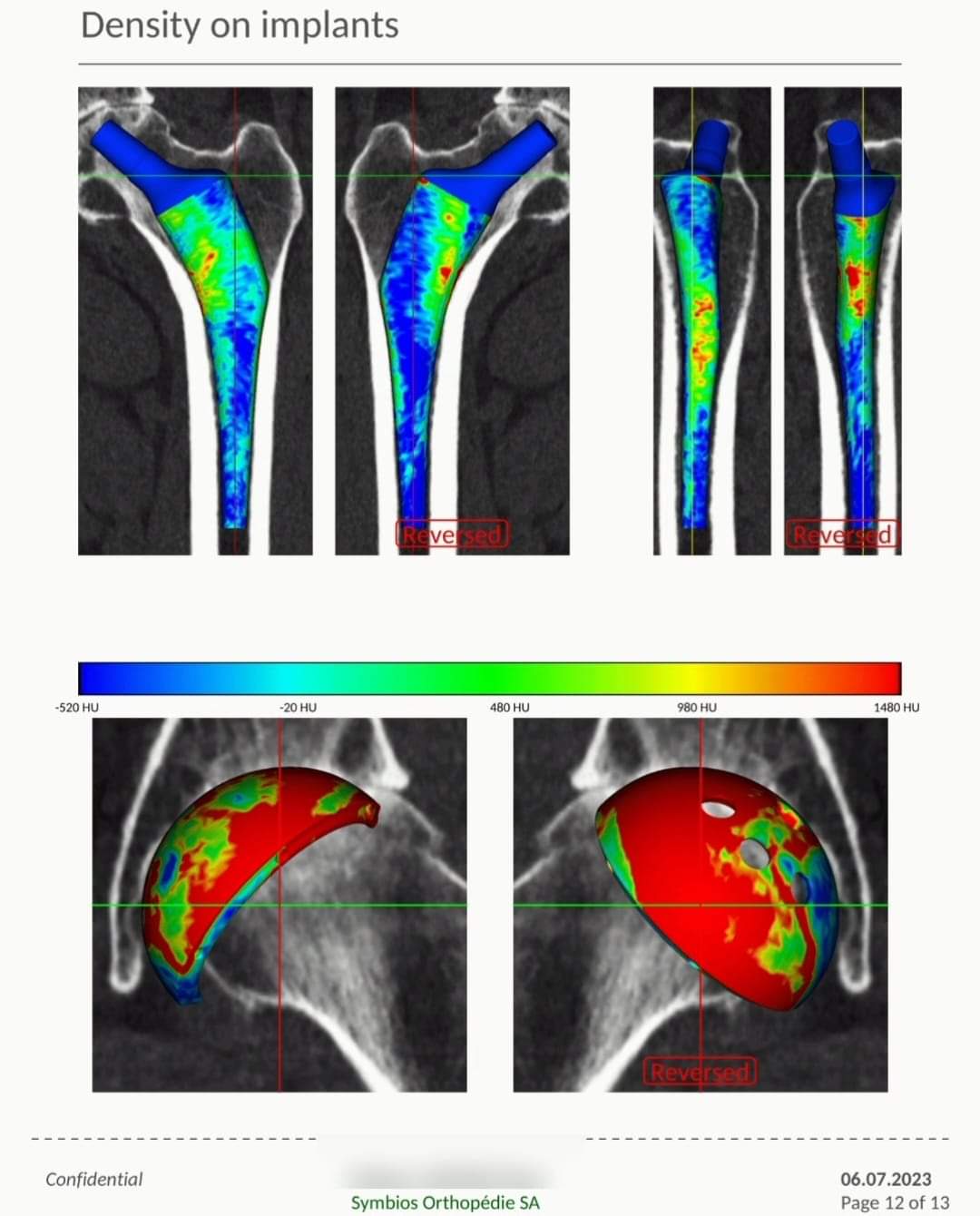 CONSTANŢA: Premieră națională la Spitalul de Urgență, unde medicii i-au ...